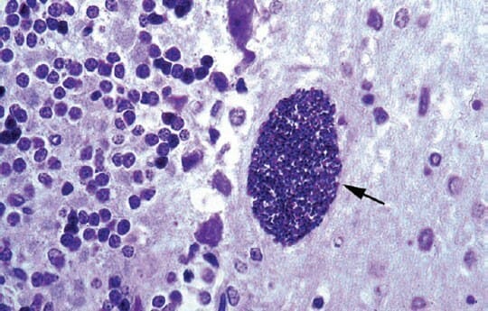 Goodpastures Stain Solution Maccallum Delta Microscopies