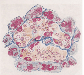 Mallory-Heidenhain Azan-Gomori's Modification, Islet Cells - Delta ...