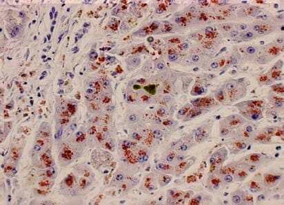 Rhodanine Method for Copper - Delta Microscopies
