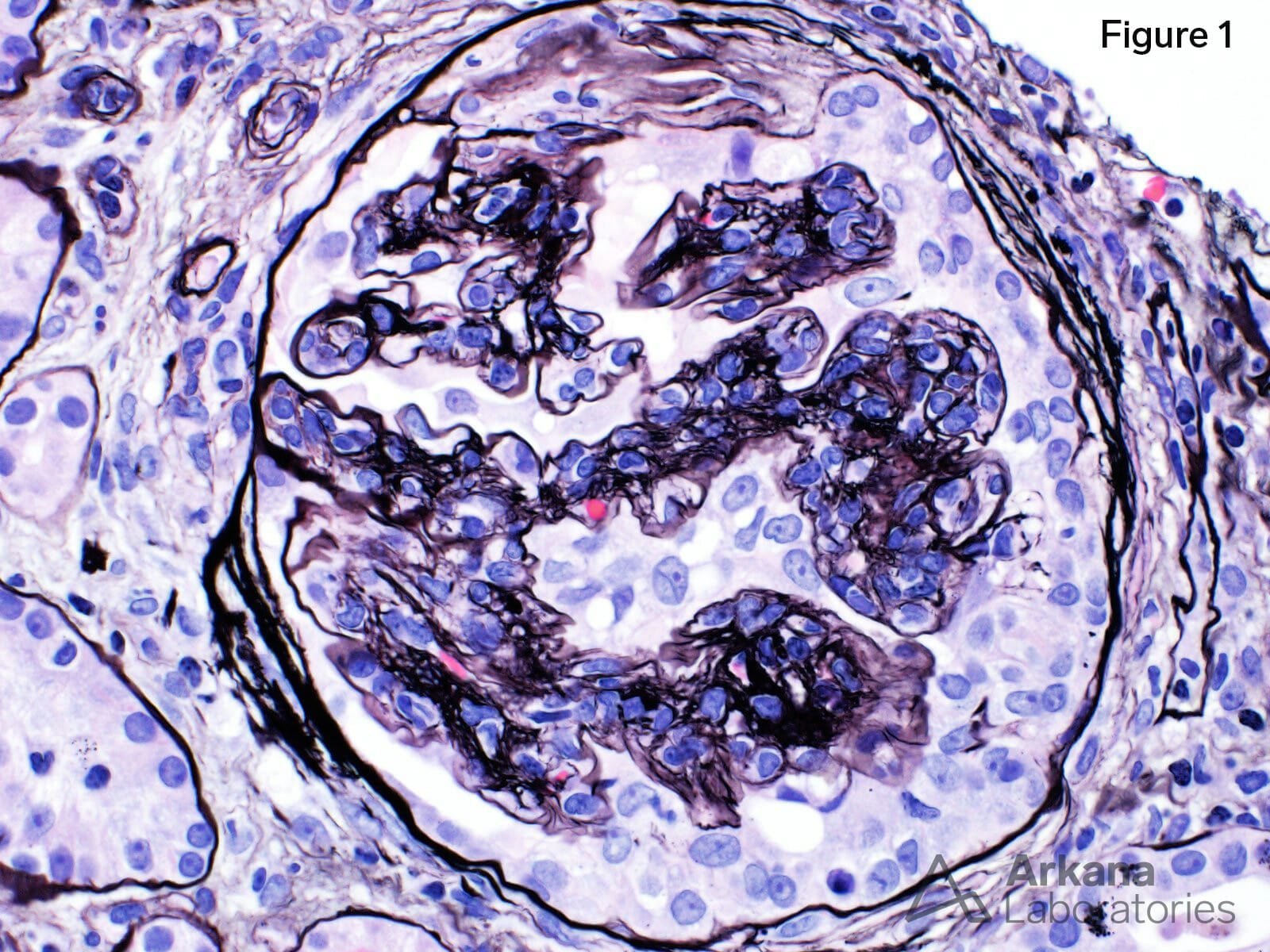 Jones Method for Kidney - Delta Microscopies